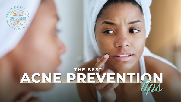 The Best Acne Prevention Tips – SpaDurban
